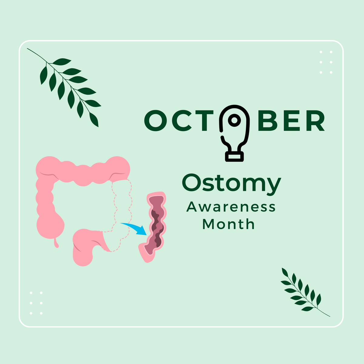 Thriving Through Transition: Uncle Charles and Alcare Stoma Bag – SM ...